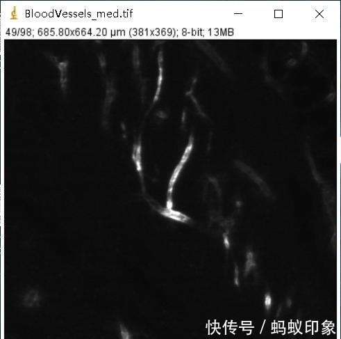 超详细！ImageJ局部放大动图、时间序列图像分析_【快资讯】