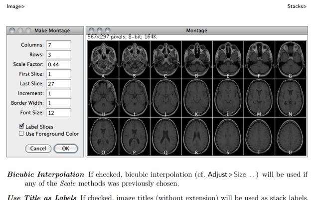 超详细！ImageJ局部放大动图、时间序列图像分析_【快资讯】