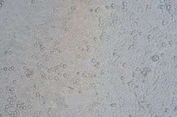 HepG2，人肝癌细胞(已通过STR鉴定)_【快资讯】